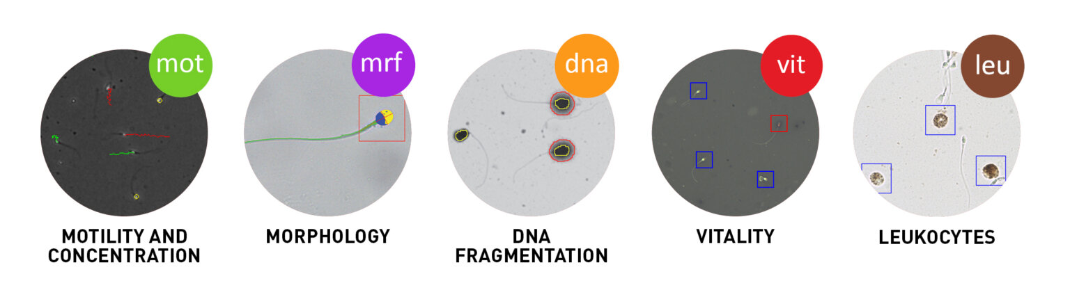 SCA SCOPE : GYNEMED GmbH & Co. KG